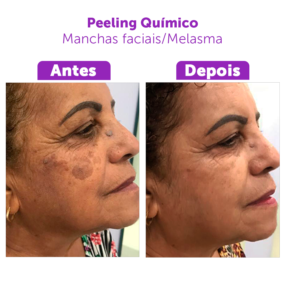 Pró-Corpo Estética Avançada | Tratamentos Faciais e Corporais
