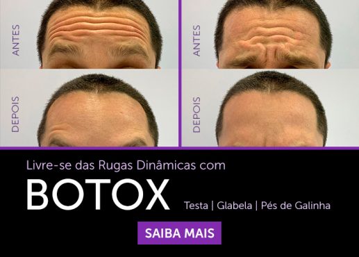 home-mobile-botox | Pró-Corpo Estética Avançada